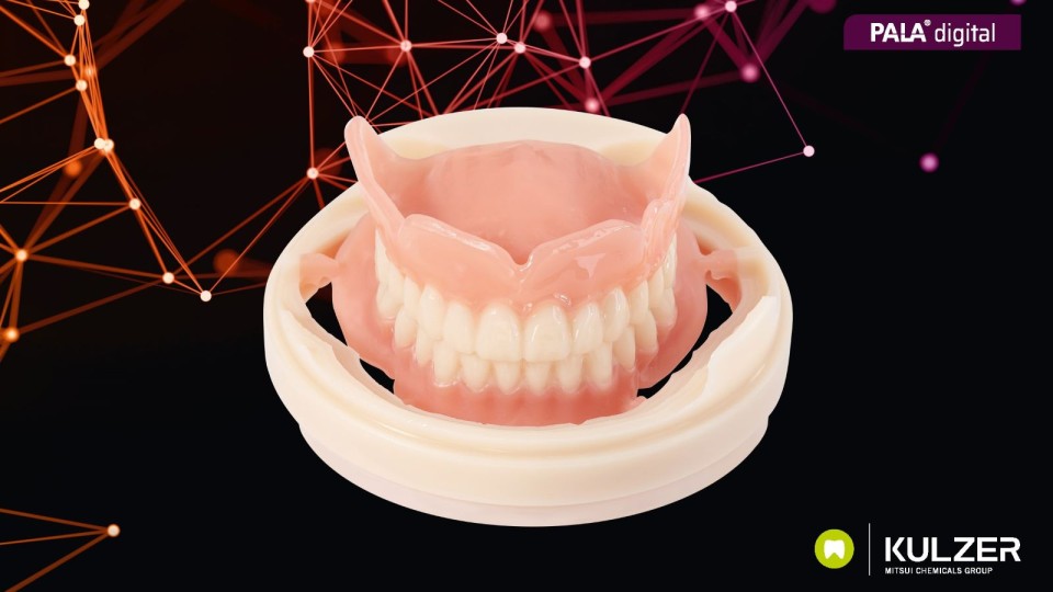 Pala Mill & Cast – Der digitale Workflow für Totalprothesen